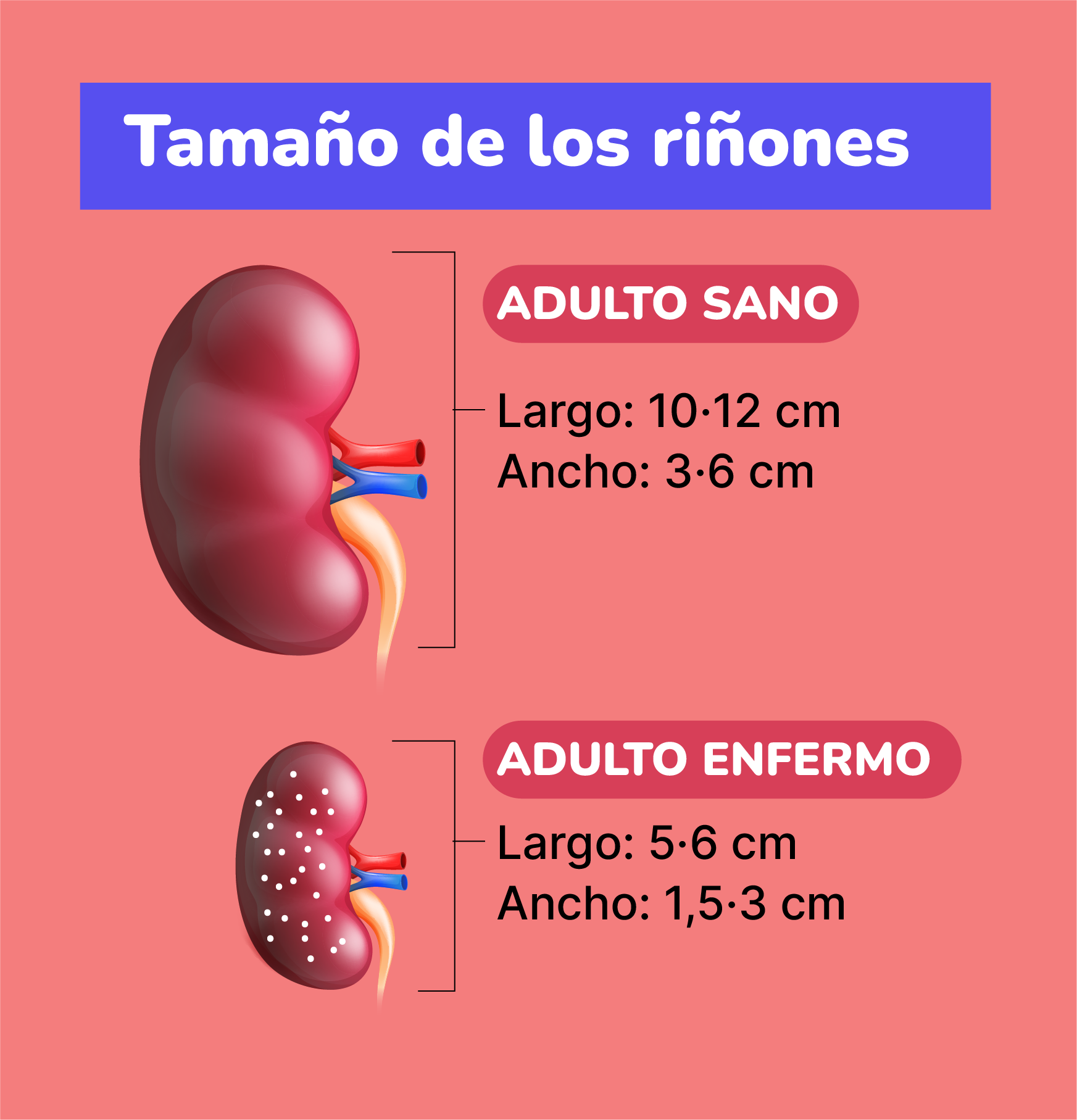 ¿Conoces la vinculación entre la Diabetes y la Enfermedad Renal ...